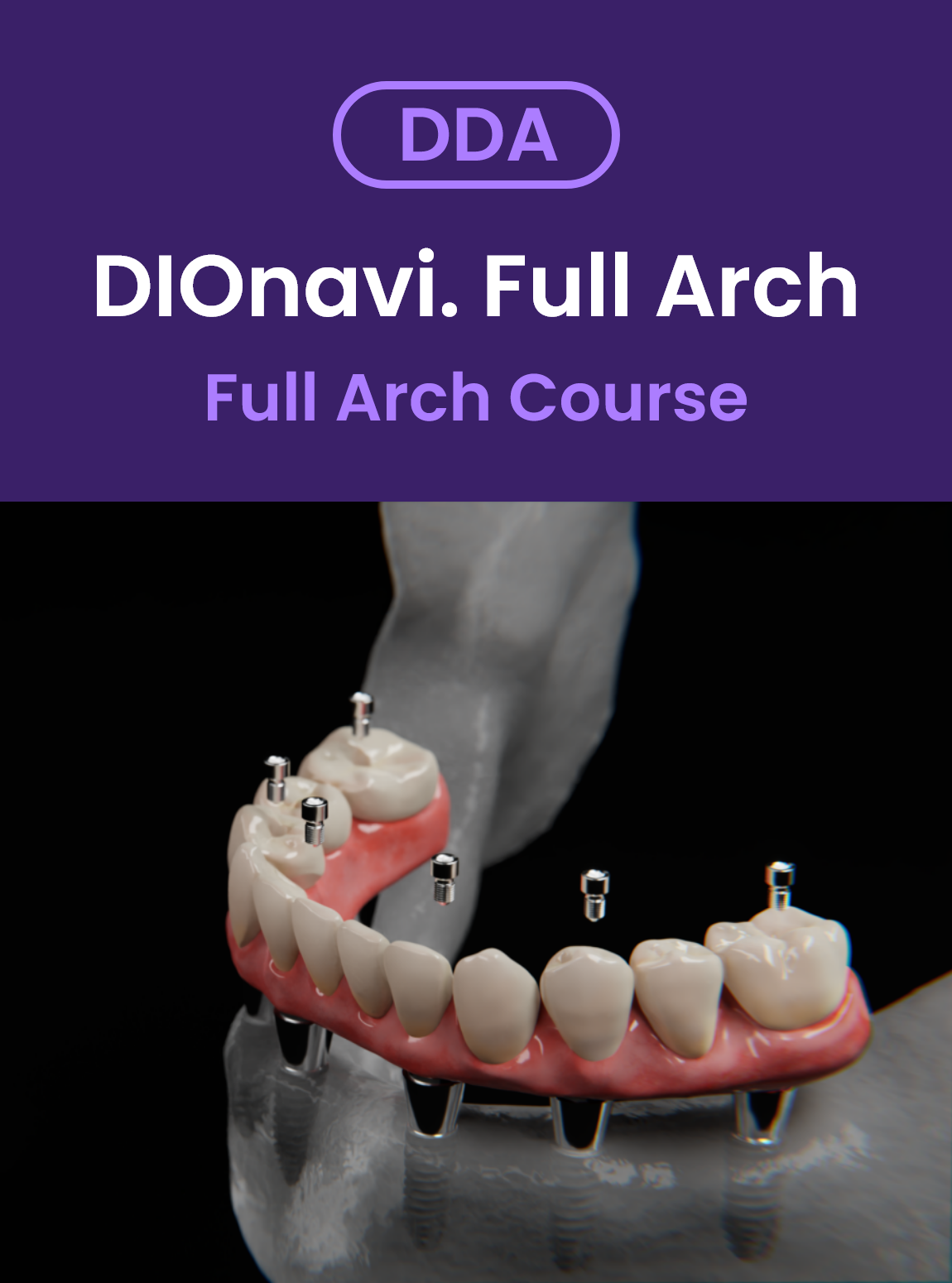 DIO IMPLANT | DIO Implant Academy